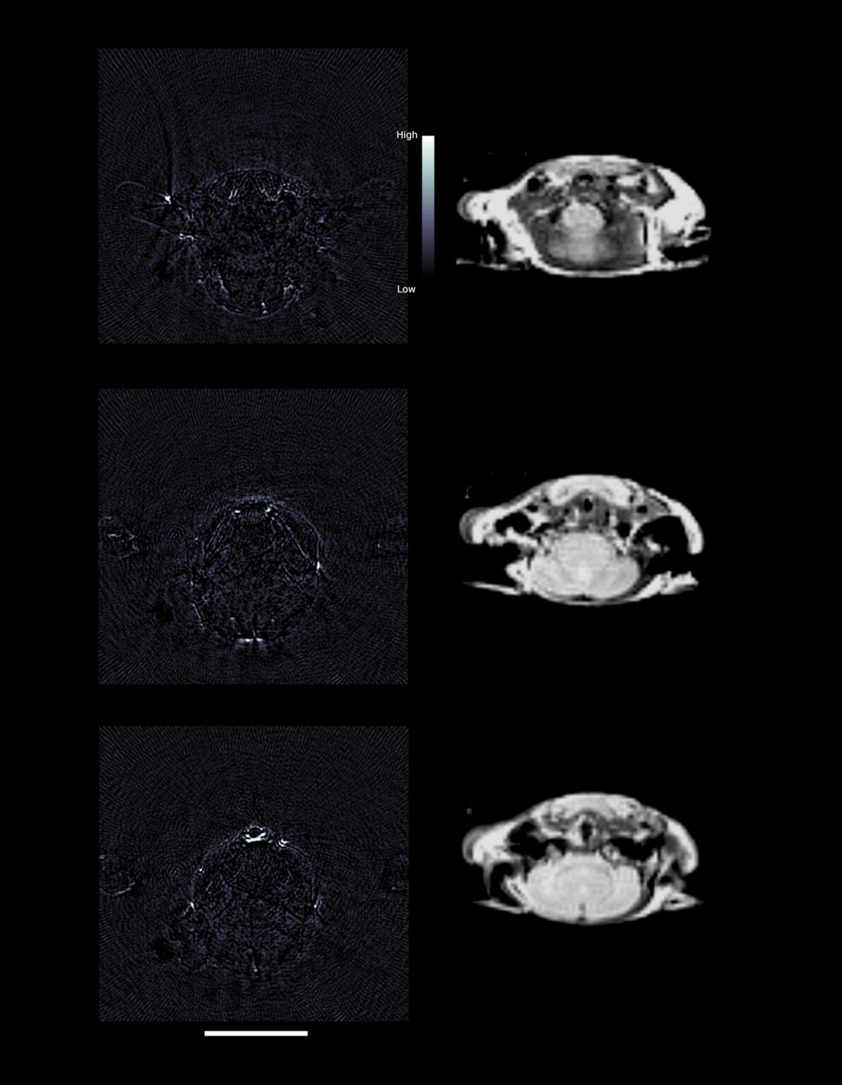 Neuroimaging – PhotoSound