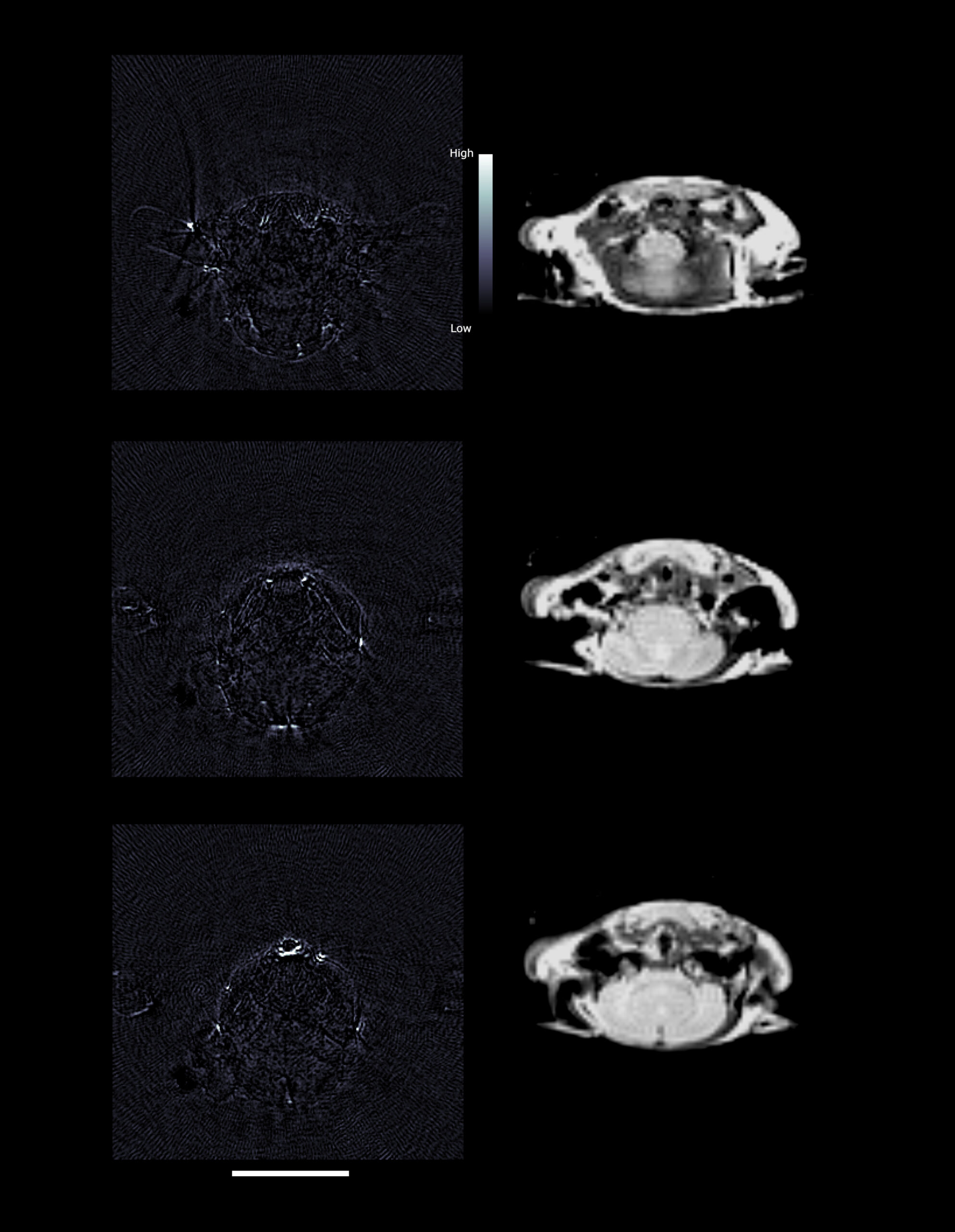 Neuroimaging – PhotoSound