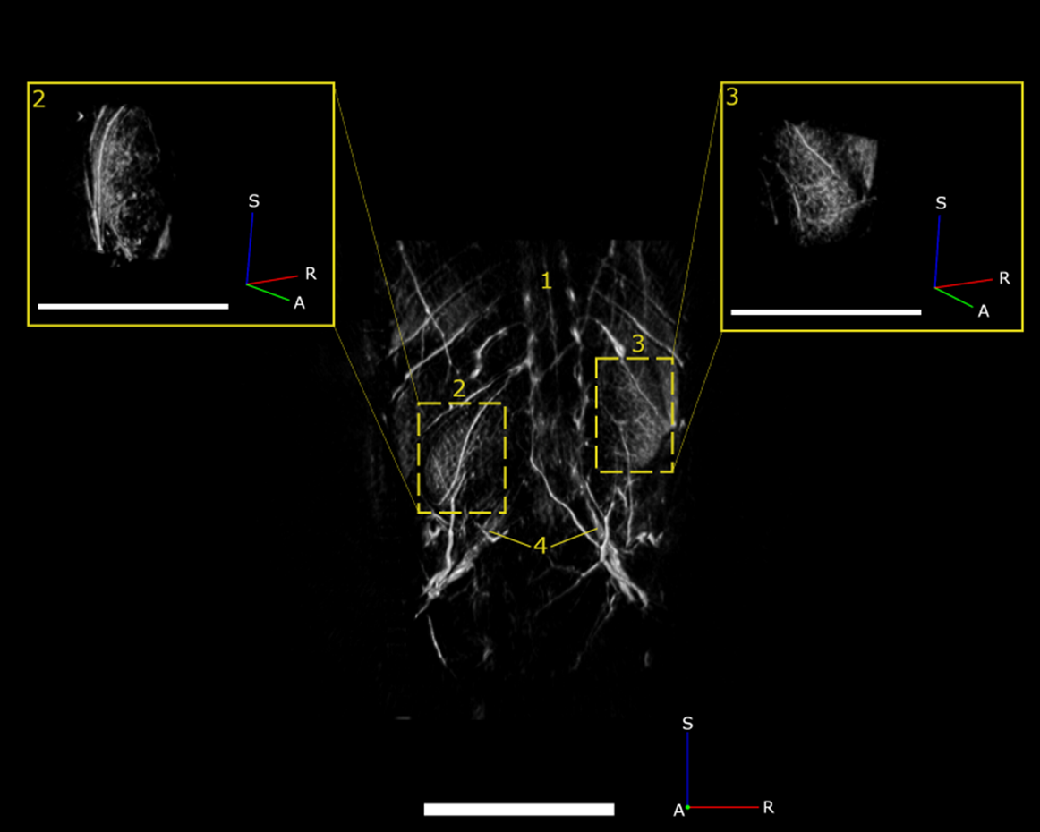 Anatomical Imaging Application Note – PhotoSound
